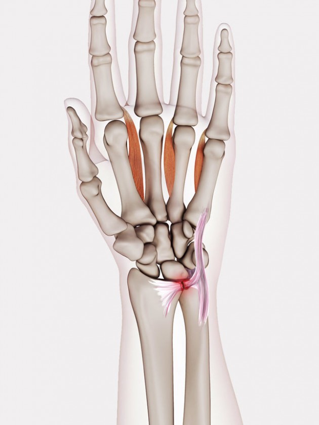 Wrist support AM-OSN-U-10